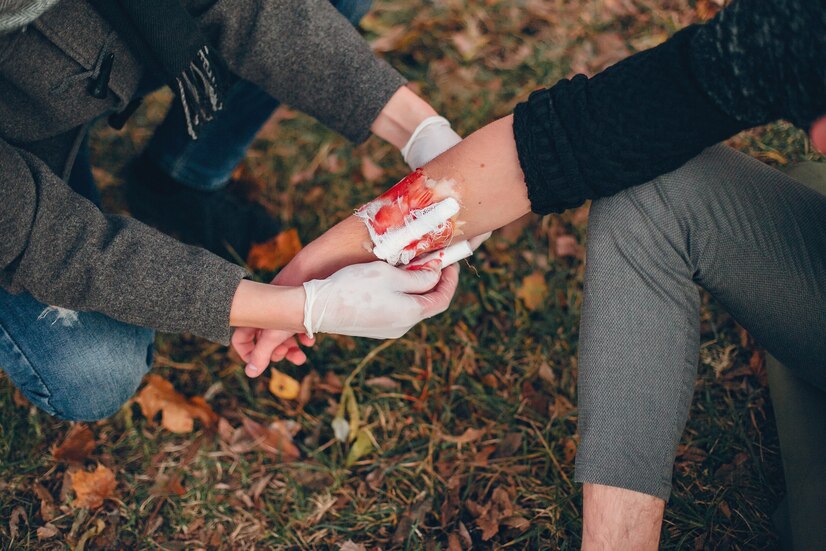 How to Handle Bleeding in an Emergency